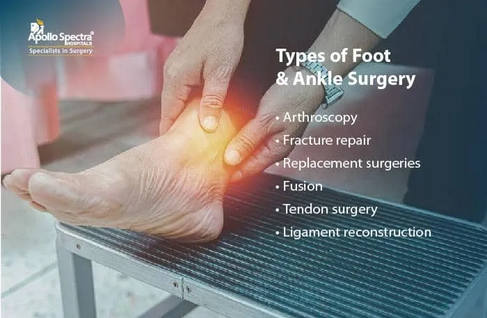 Understanding Foot and Ankle Surgery | Types, Signs, and Risks