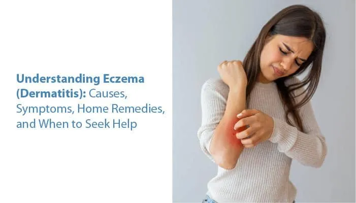 Understanding Eczema (Dermatitis): Causes, Symptoms, Home Remedies, and ...