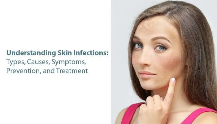 Understanding Hyperpigmentation: Causes, Types, Prevention, Treatments ...