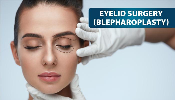 Eyelid surgery blog online