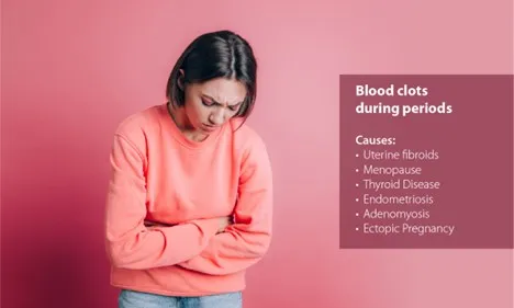 Blood Clots During Periods Explained: Causes & Health Tips - Apollo Spectra