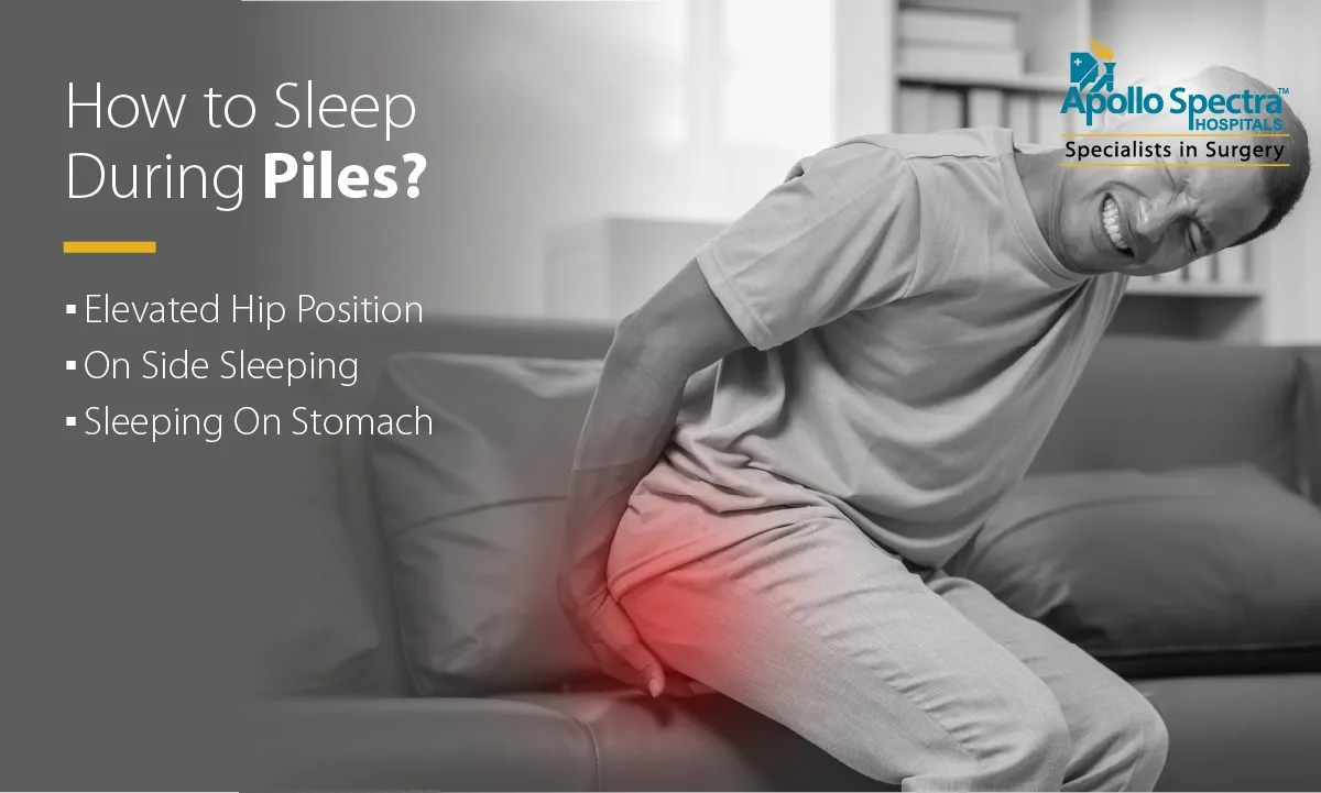 How to Sleep During Piles? | Best Sleeping Position for Piles