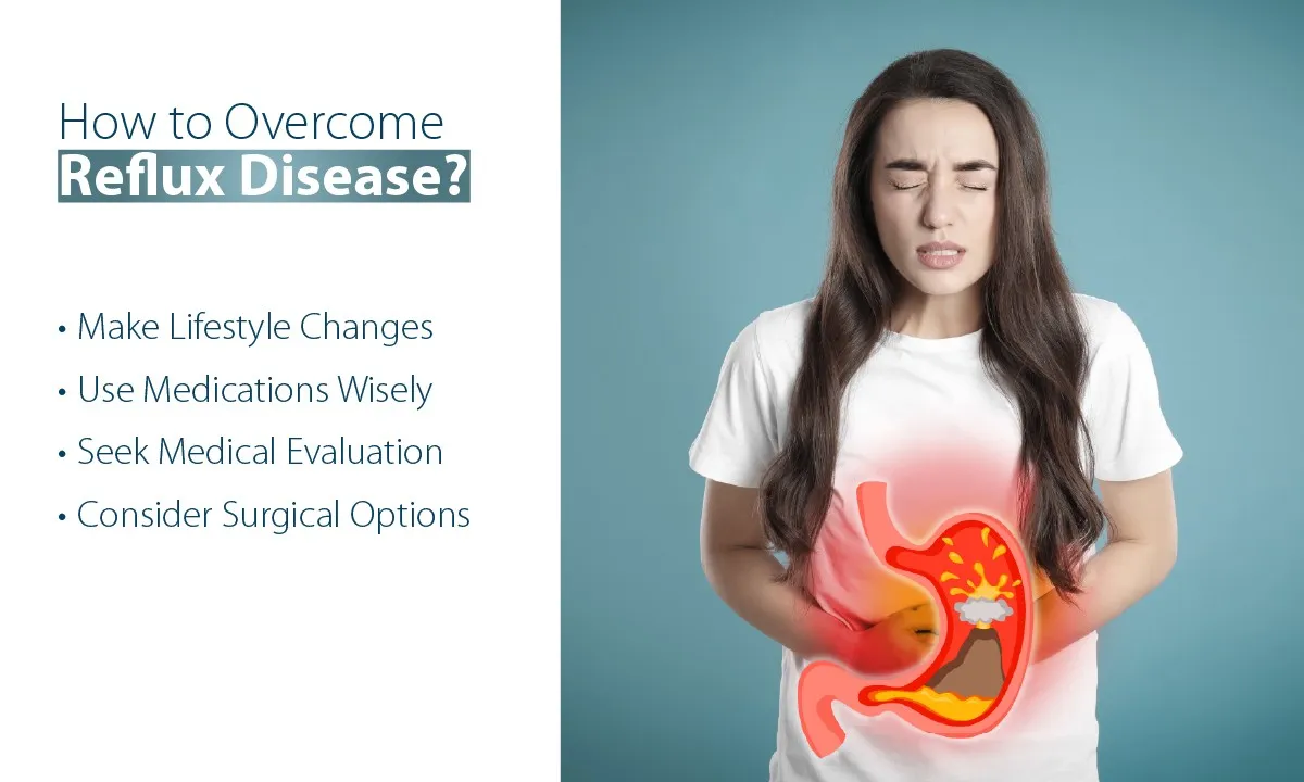 GERD Treatment & Relief: Say Goodbye to Heartburn